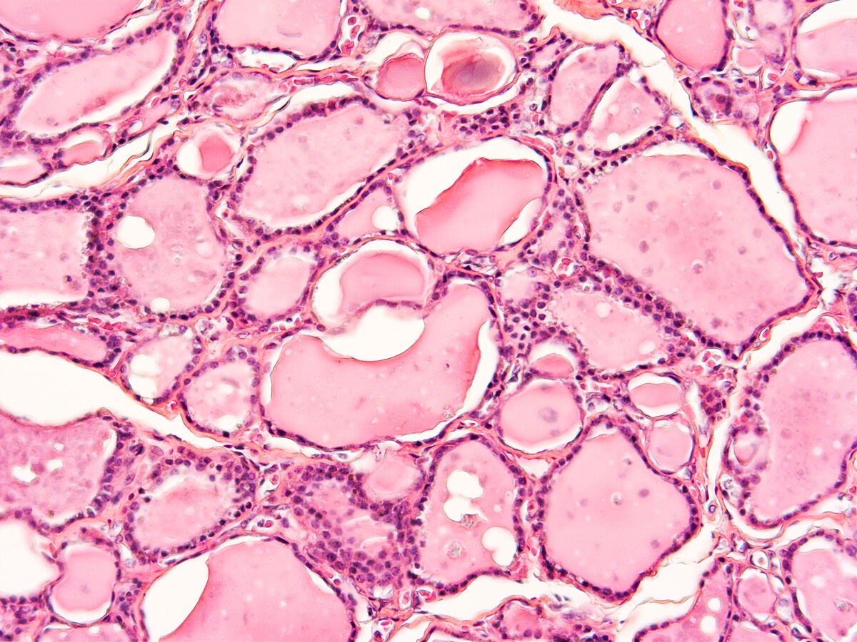 Menschliches Gewebe | HLfGP.hessen.de